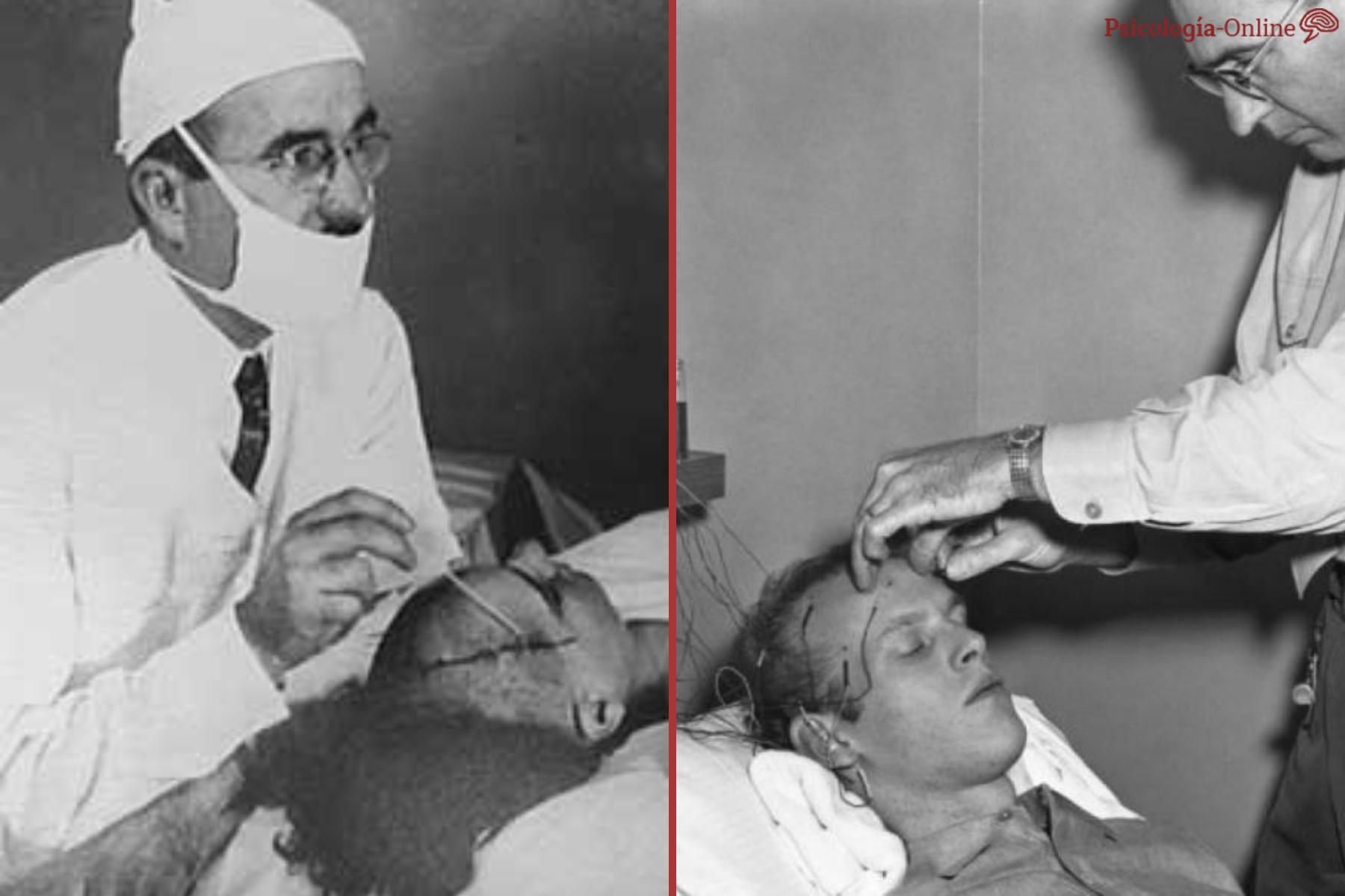 O Que é Lobotomia Cerebral - RETOEDU