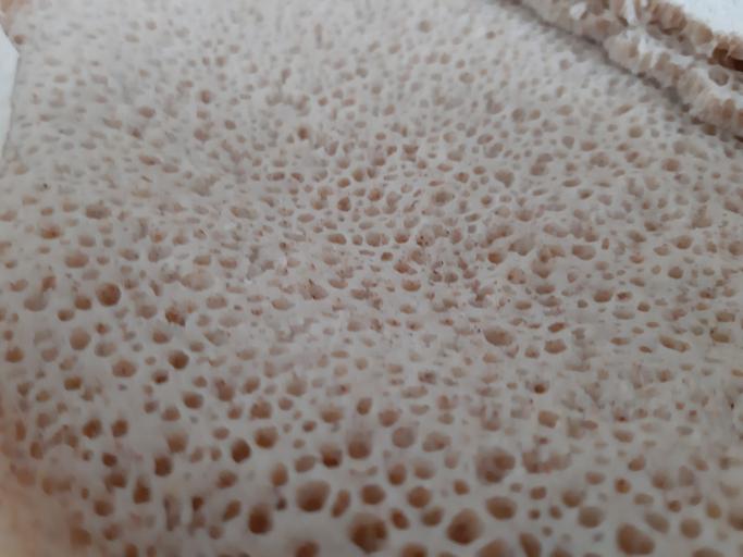 MICROFOBIA: qué es, síntomas, causas y tratamiento