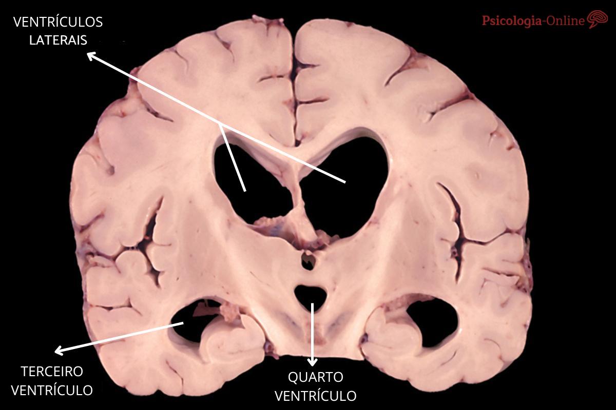 Sistema ventricular cerebral: o que é, partes e funções